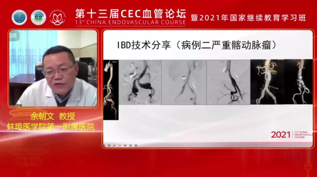 「会后直击」先见·聚焦腔内重建髂内动脉——先健专场活动@CEC2021